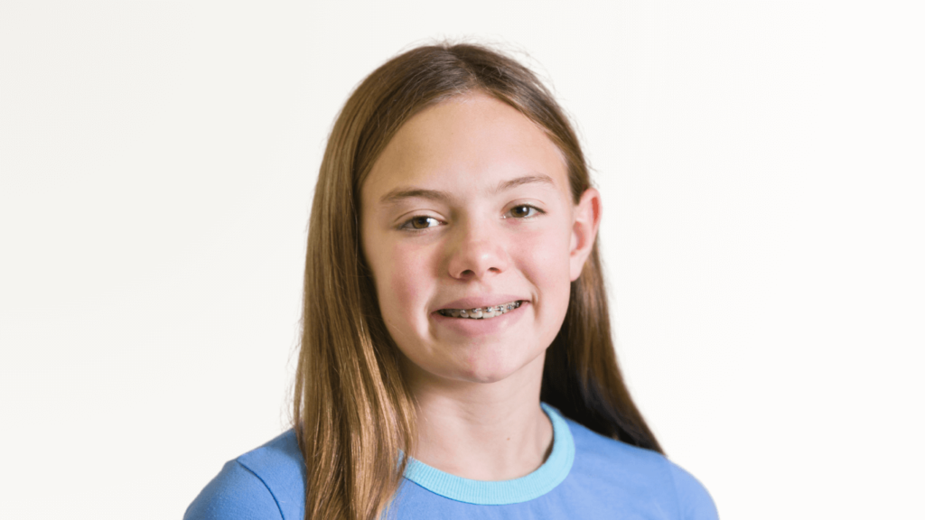 Damon Braces | Faster, Comfortable Orthodontic Treatment
